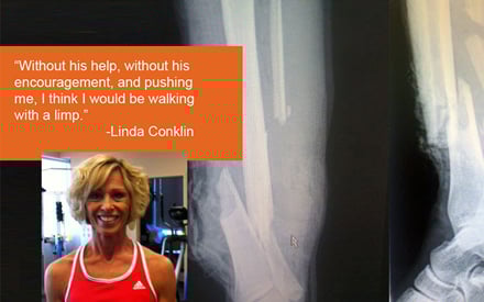 Patient Story | Traumatic Leg Injury Recovery: Linda's Story | Choose PT